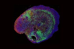 Human Brain Organoids Are Learning to Play Video Games. That Is Only ...