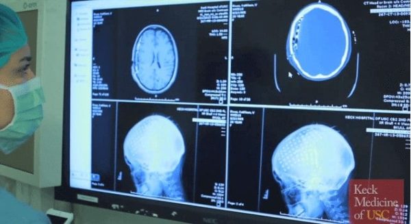 How Rabies Hijacks Neurons to Attack the Brain - ScienceBlog.com