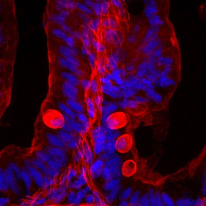 Controlling cell turnover in the intestinal lining - ScienceBlog.com