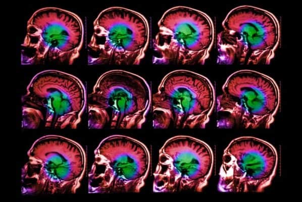 Our brains are obsessed with being social - ScienceBlog.com