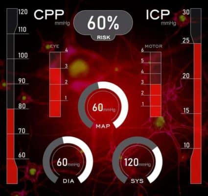Artificial intelligence-based algorithm for intensive care of traumatic ...