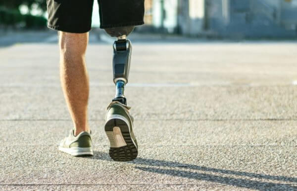Helping the body and brain to welcome bionic limbs and implants ...