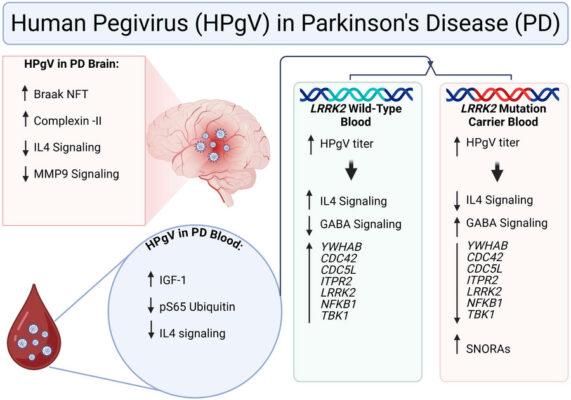Little-Known Virus Found in Half of Parkinson's Brains - ScienceBlog.com