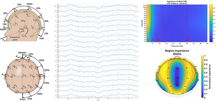 AI Cracks Dementia Diagnosis Using Simple Brain Scans - ScienceBlog.com
