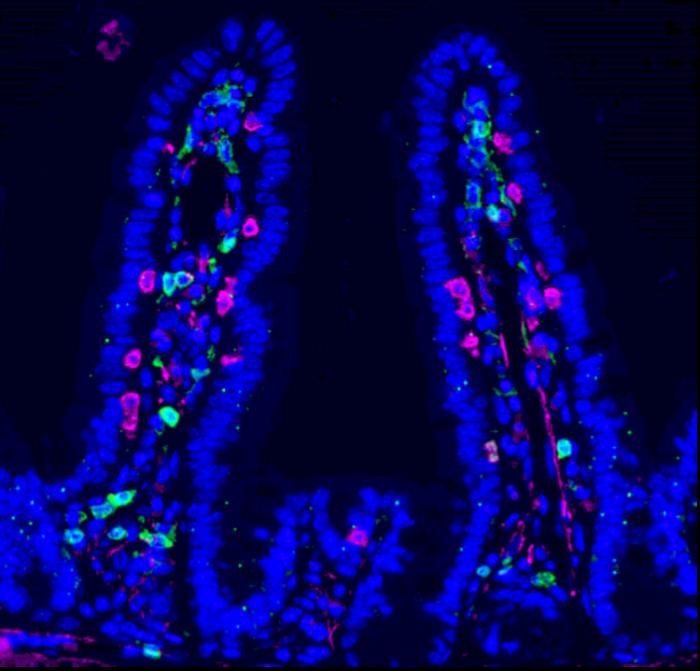 Intestinal Damage from Chemo Might Be Essential for Preventing Cancer ...