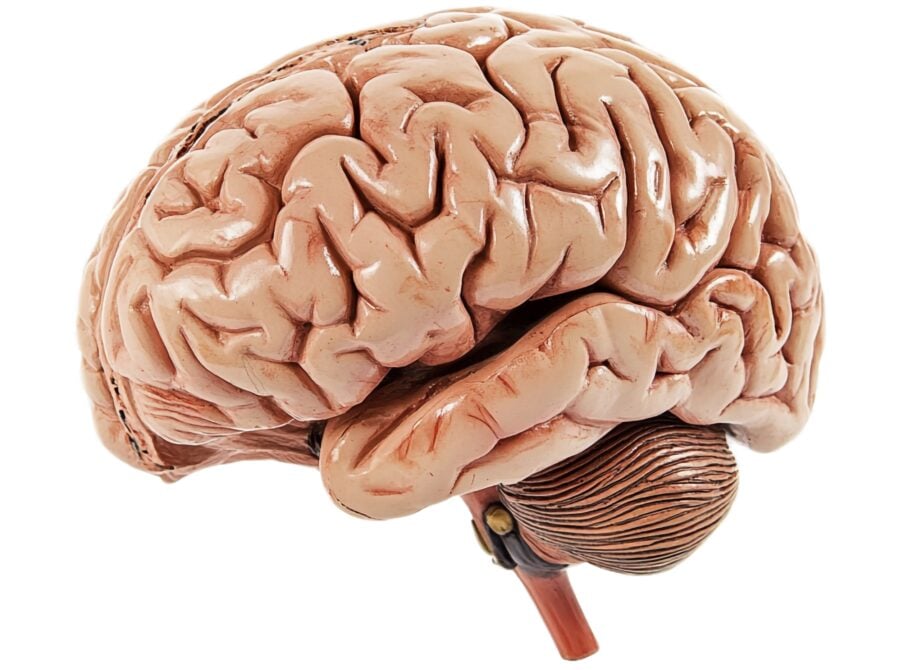 AI Tool Maps the Brain Stem, Our Most Elusive Wiring, for the First ...
