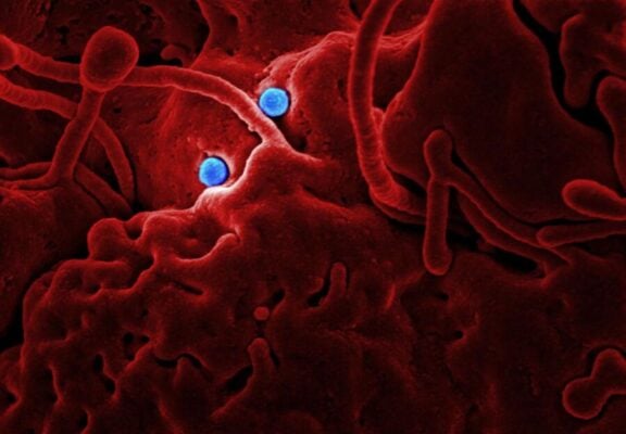 Why a Detectable HIV Test Result Can Mean the Virus Is Already Broken ...