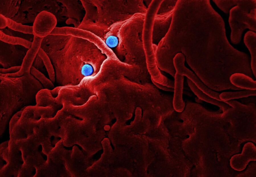 Why a Detectable HIV Test Result Can Mean the Virus Is Already Broken ...